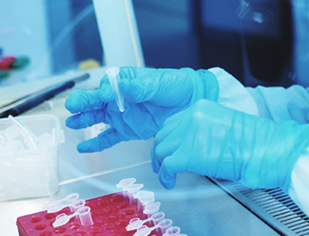 OneBAT. A One Health approach to the study and prevention of bat-borne ...